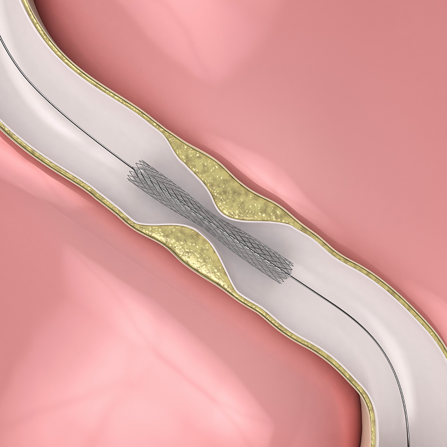 11 biomaterials that can heal the human body. Including, yes, biting ...