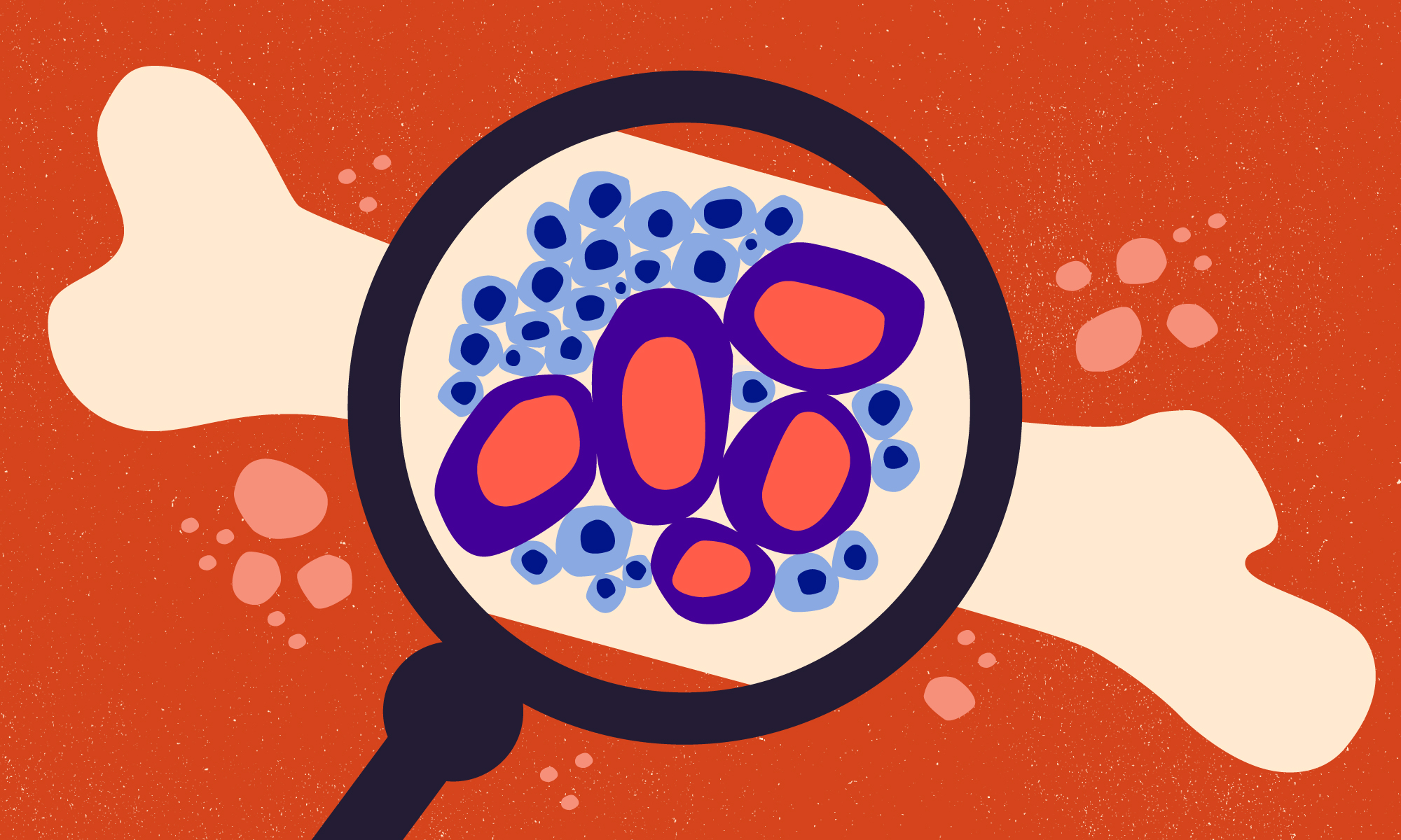 Searching for the history of cancer in ancient human bones