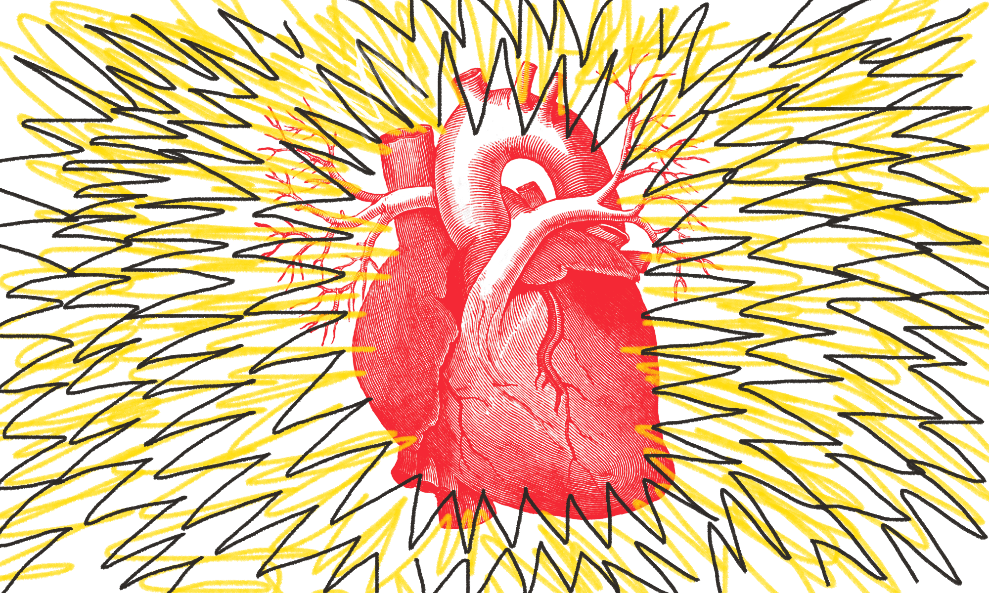 Implantable defibrillators save lives, but their shocks may cause PTSD ...